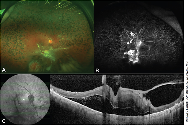 Ophthalmology Management | PentaVision