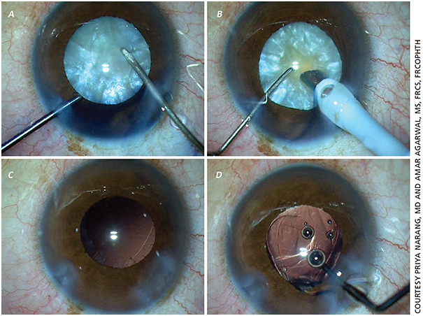 Ophthalmology Management | PentaVision