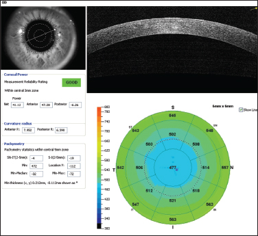 Ophthalmology Management | PentaVision