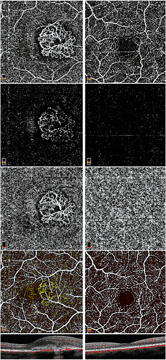 Ophthalmology Management | PentaVision