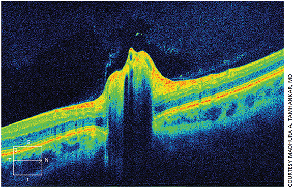 Ophthalmology Management | PentaVision