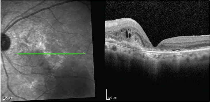 Ophthalmology Management | PentaVision