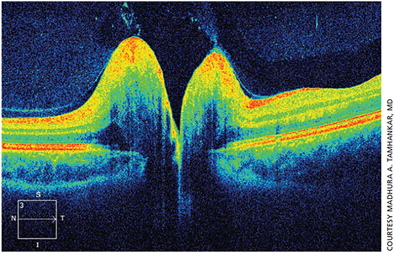 Ophthalmology Management | PentaVision