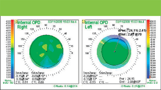 Ophthalmology Management | PentaVision