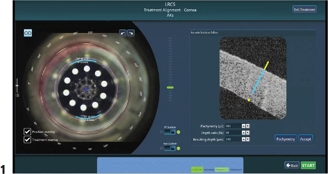 Ophthalmology Management | PentaVision