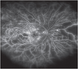 Ophthalmology Management | PentaVision