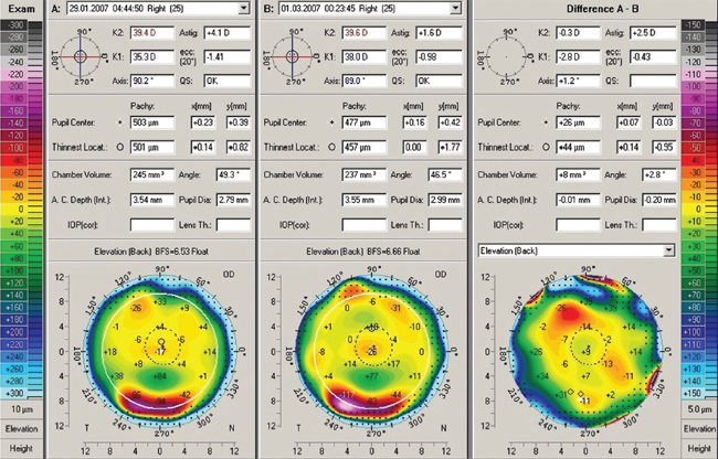 Ophthalmology Management | PentaVision