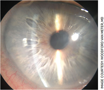 Ophthalmology Management | PentaVision