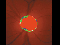 Ophthalmology Management | PentaVision
