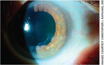 Ophthalmology Management | PentaVision
