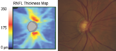 Ophthalmology Management | PentaVision