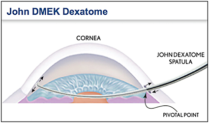Ophthalmology Management | PentaVision