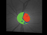 Ophthalmology Management | PentaVision