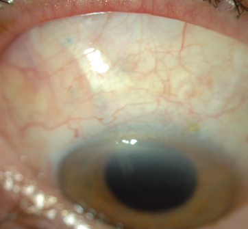 Ophthalmology Management | PentaVision