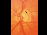 Ophthalmology Management | PentaVision