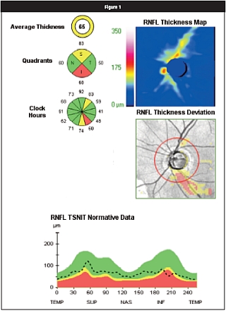 Ophthalmology Management | PentaVision