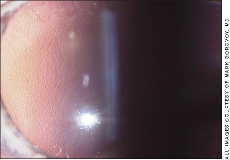 Ophthalmology Management | PentaVision