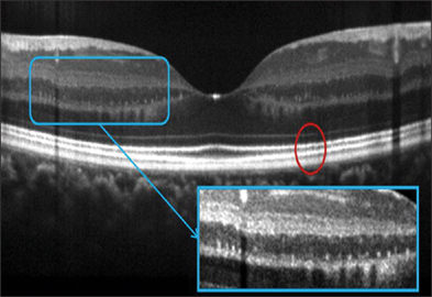 Ophthalmology Management | PentaVision