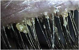 Ophthalmology Management | PentaVision