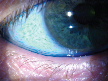 Ophthalmology Management | PentaVision