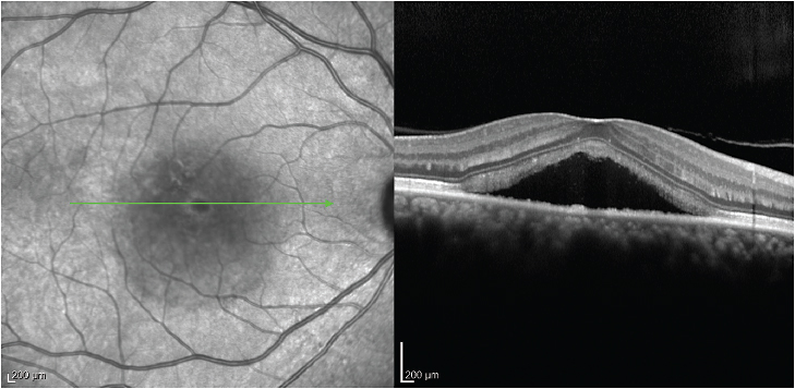 Ophthalmology Management | PentaVision