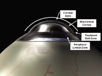 Ophthalmology Management | PentaVision