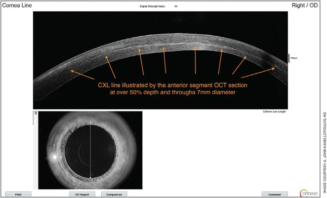 Ophthalmology Management | PentaVision