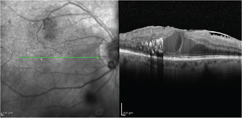 Ophthalmology Management | PentaVision