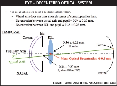 Ophthalmology Management | PentaVision