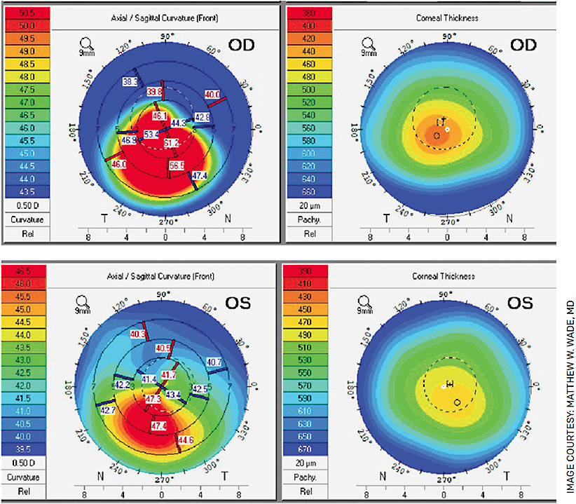 Ophthalmology Management | PentaVision