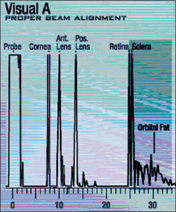 Ophthalmology Management | PentaVision
