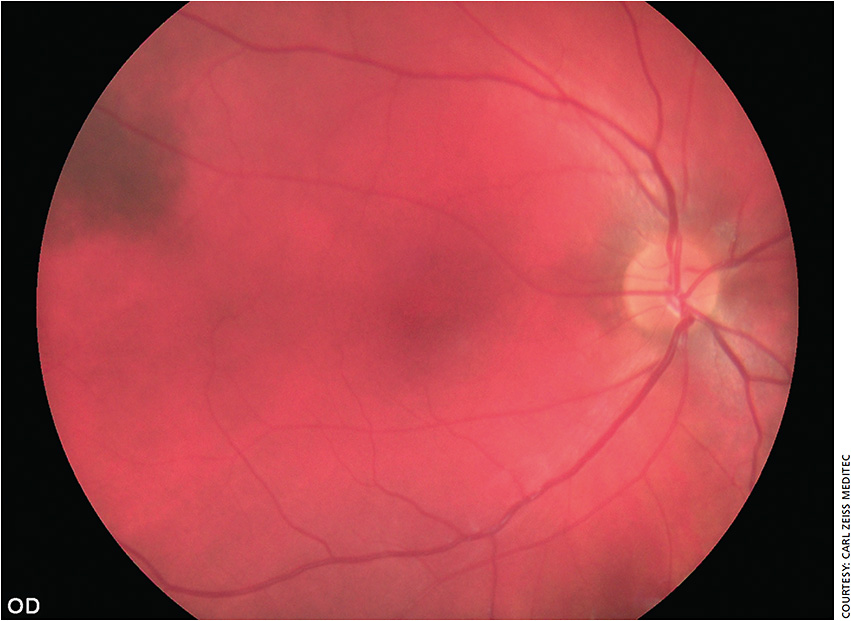 Ophthalmology Management | PentaVision