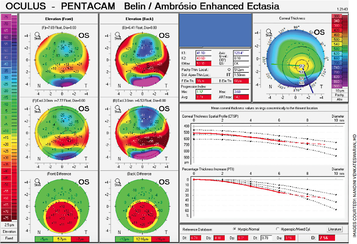 Ophthalmology Management | PentaVision