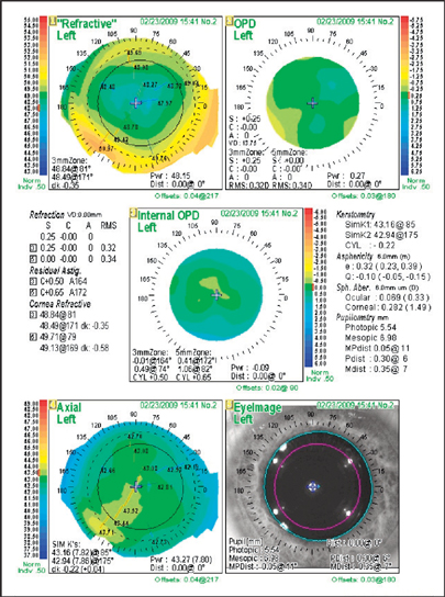 Ophthalmology Management | PentaVision