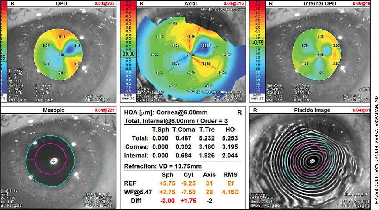 Ophthalmology Management | PentaVision