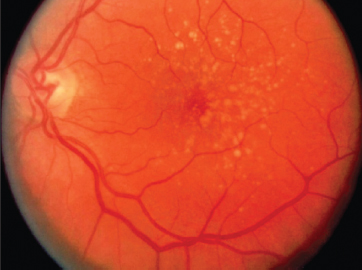 Ophthalmology Management | PentaVision