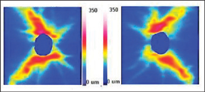 Ophthalmology Management | PentaVision