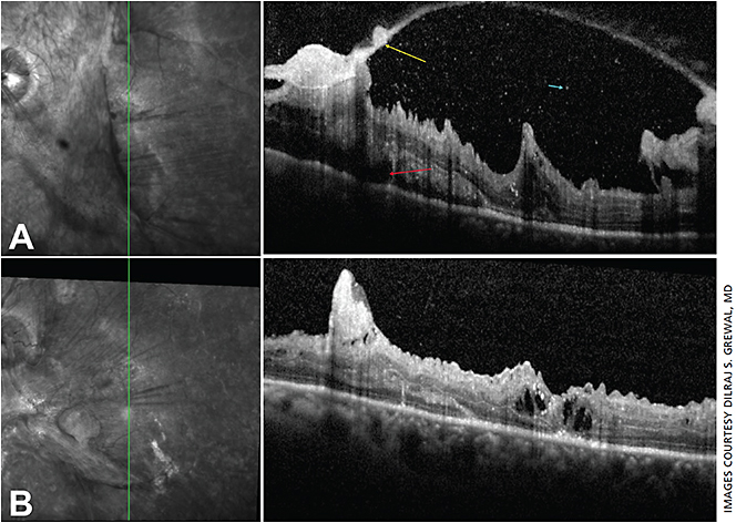 Ophthalmology Management | PentaVision