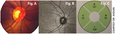 Ophthalmology Management | PentaVision