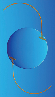 Ophthalmology Management | PentaVision