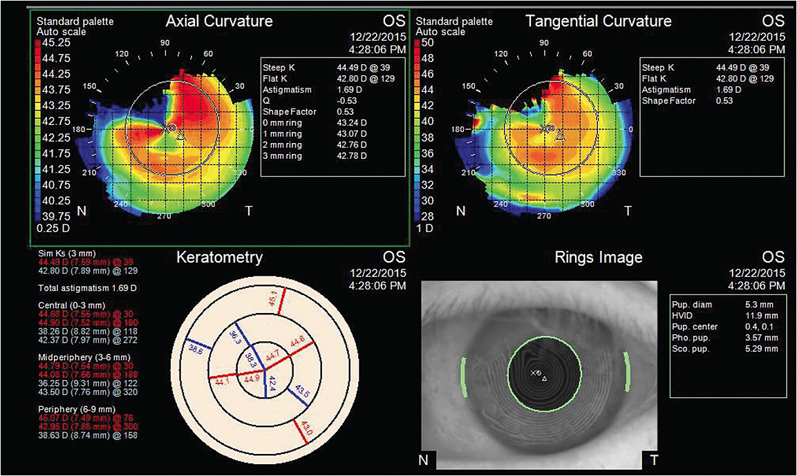 Ophthalmology Management | PentaVision