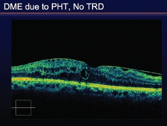 Ophthalmology Management | PentaVision