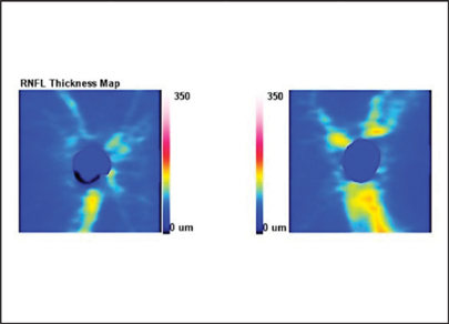 Ophthalmology Management | PentaVision