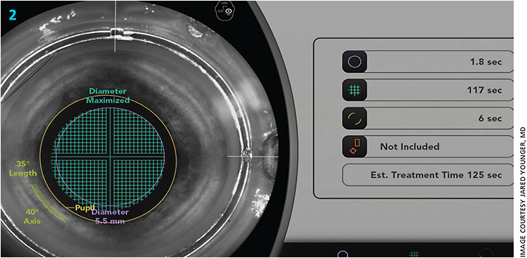 Ophthalmology Management | PentaVision