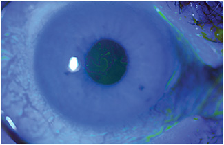 Ophthalmology Management | PentaVision