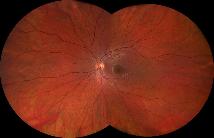 Ophthalmology Management | PentaVision