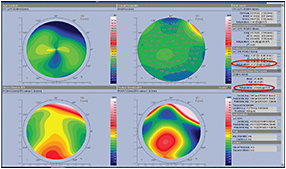 Ophthalmology Management | PentaVision