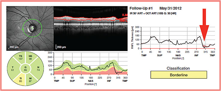 Ophthalmology Management | PentaVision