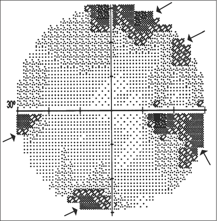Ophthalmology Management | PentaVision