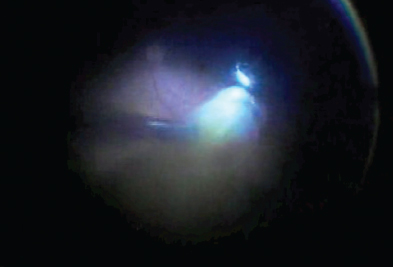 Ophthalmology Management | PentaVision